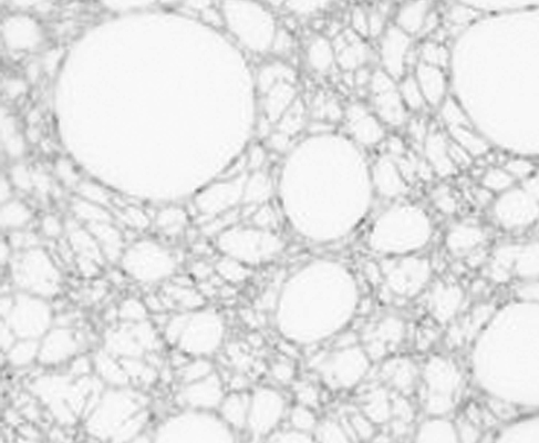 Our Range of Grids | Quantifoil